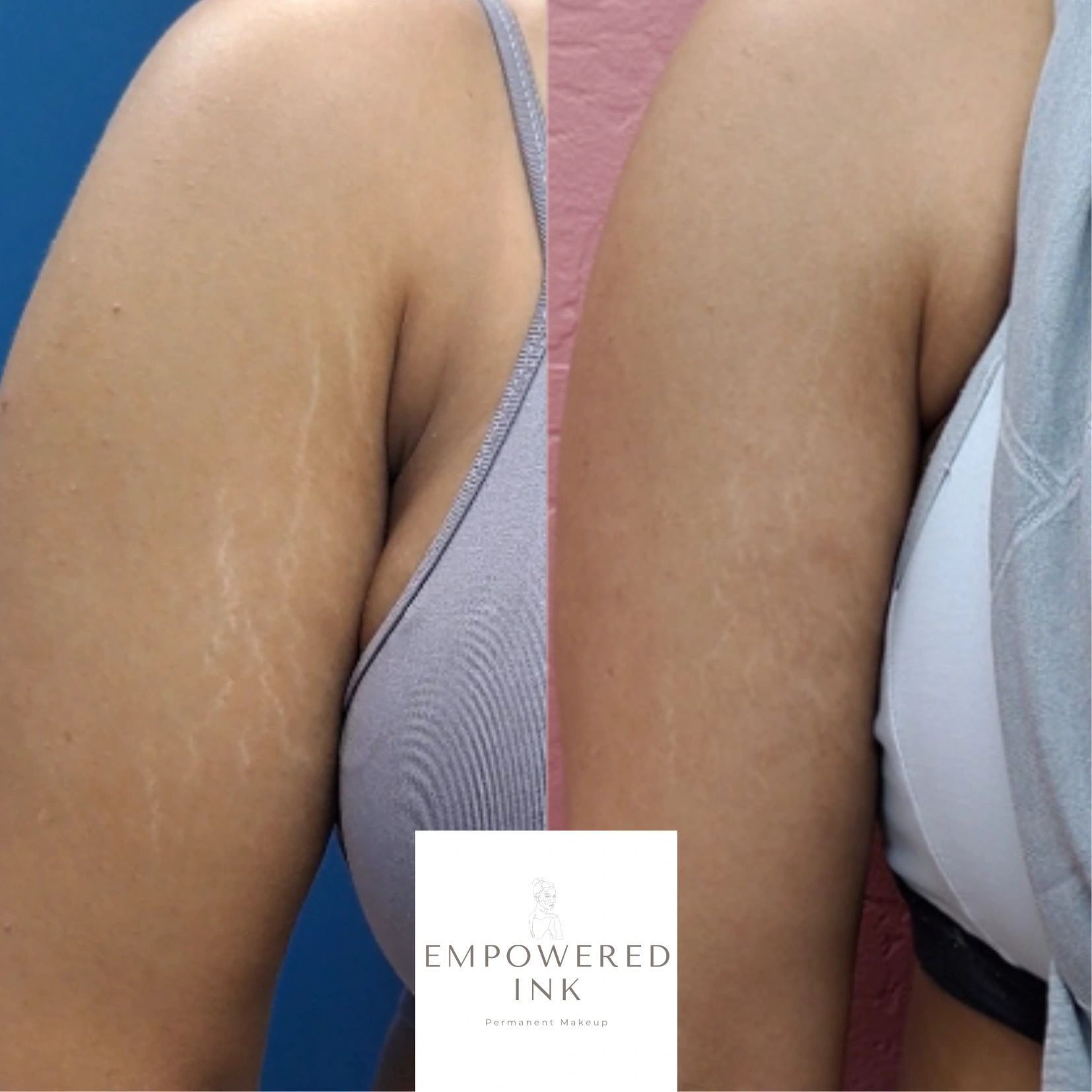 Inkless Stretch Mark Camouflage